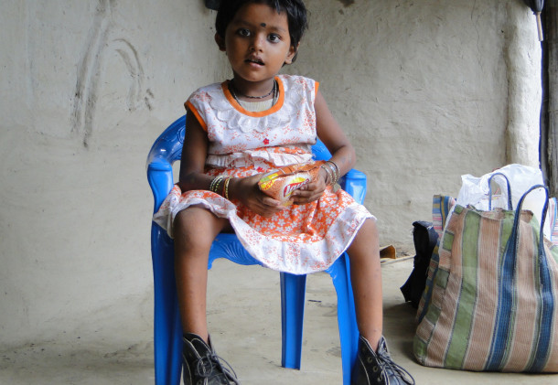 Oddity and wonders funny pictures: Operation of a girl with 4 arms and ...