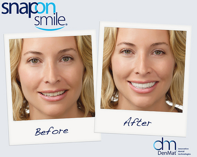 Clinica Dental: Snap on Smile