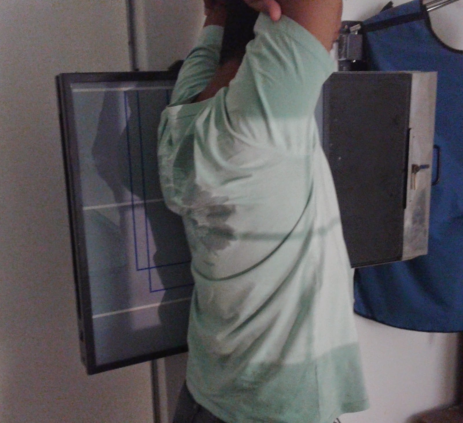 DICAS DE RADIOLOGIA: TÉCNICAS RADIOLÓGICAS - POSICIONAMENTO RX DO TÓRAX ...