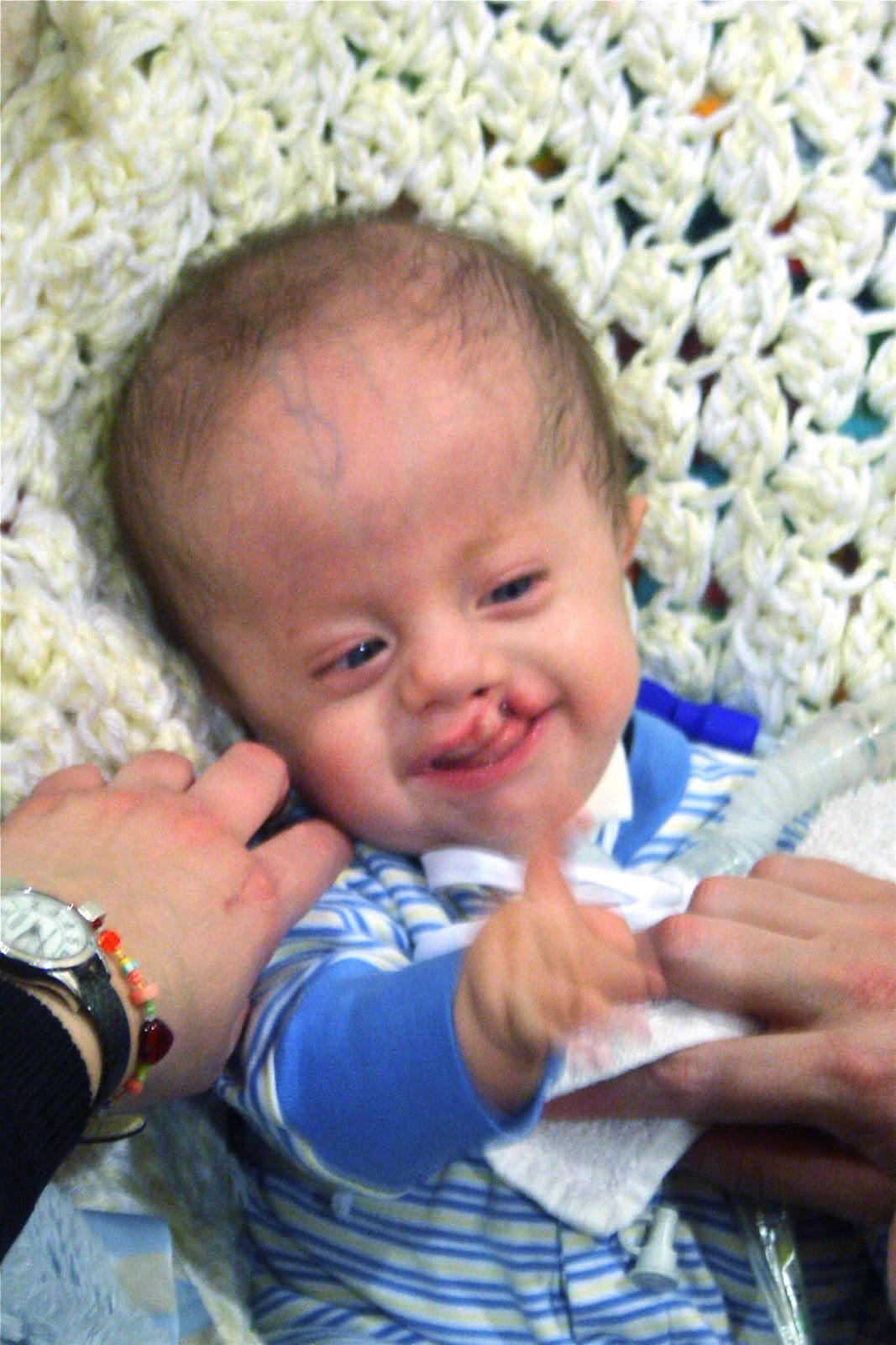 Compatible With Joy-Trisomy18: 03/01/2011 - 04/01/2011