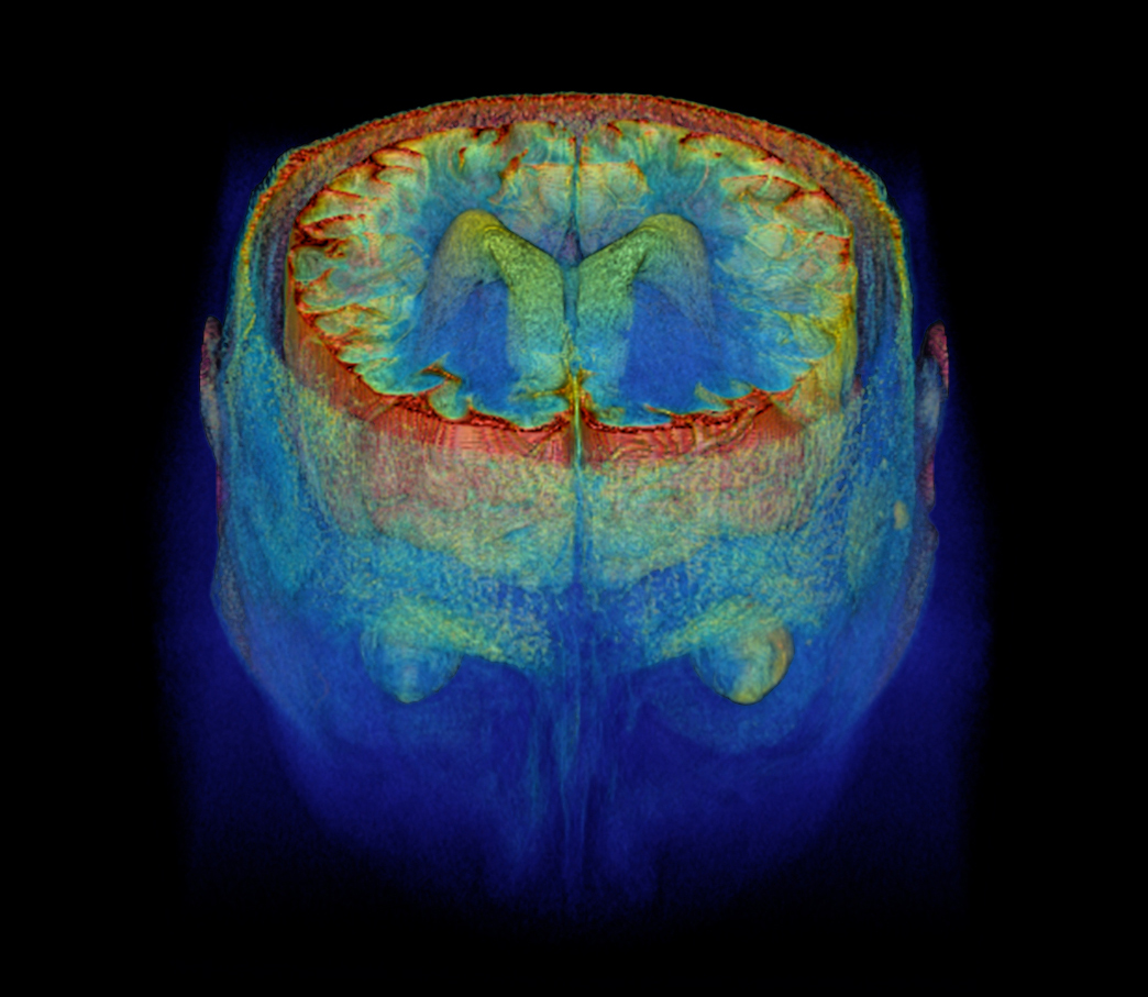 It's All In The Egg: The Computational Brain