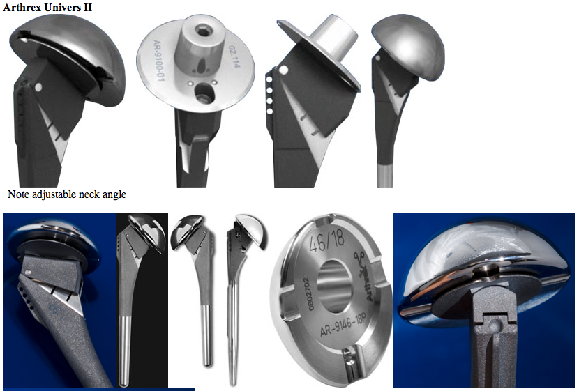 Shoulder and Elbow Surgery: Identifying the implanted shoulder ...