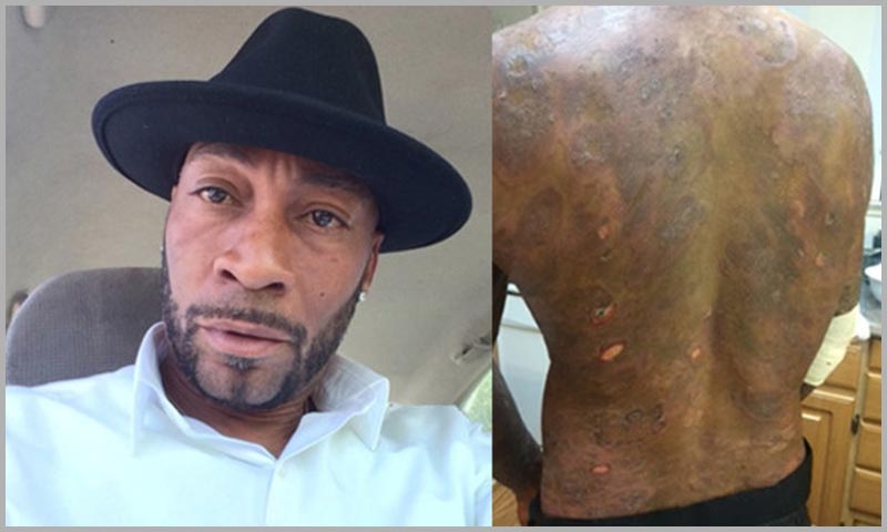 Vietnam Urges Monsanto To Finally Pay For Horrifying Mutations Brought ...