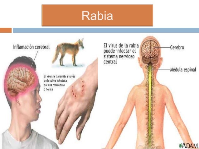 La Prevención De Diversas Enfermedades La Rabia ¿que Es Y Como