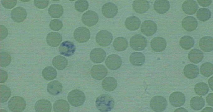 Sobre os reticulócitos