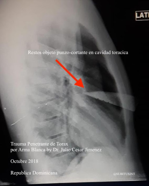 EMS SOLUTIONS INTERNATIONAL by @DrRamonReyesMD marca registrada: TRAUMA ...
