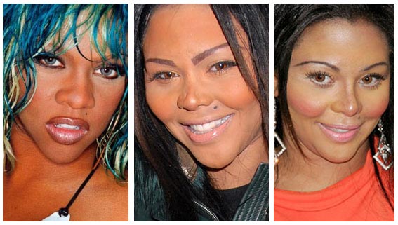 Lil Kim Plastic Surgery Before and After Breast Implants, Nose Job ...