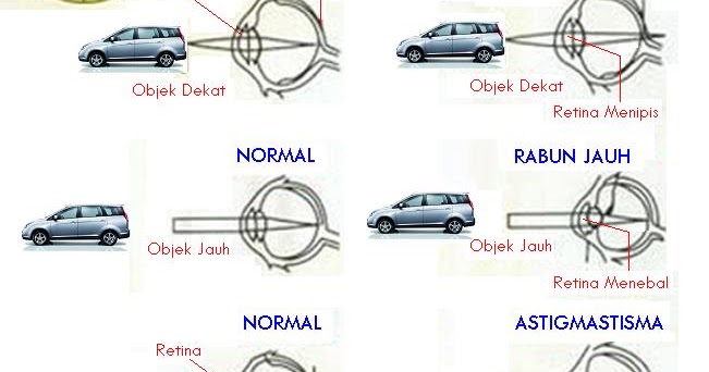Tahap Bacaan Rabun Jauh - soakploaty