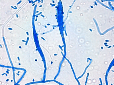 Fun With Microbiology (What's Buggin' You?): Microsporum audouinii