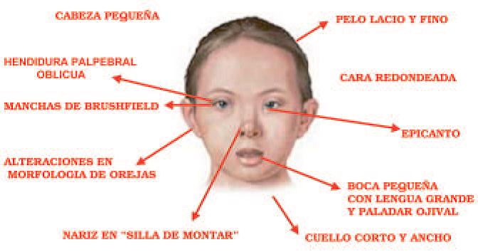 Psicologia Para Todos: Celebramos Hoy el día Síndrome de Down