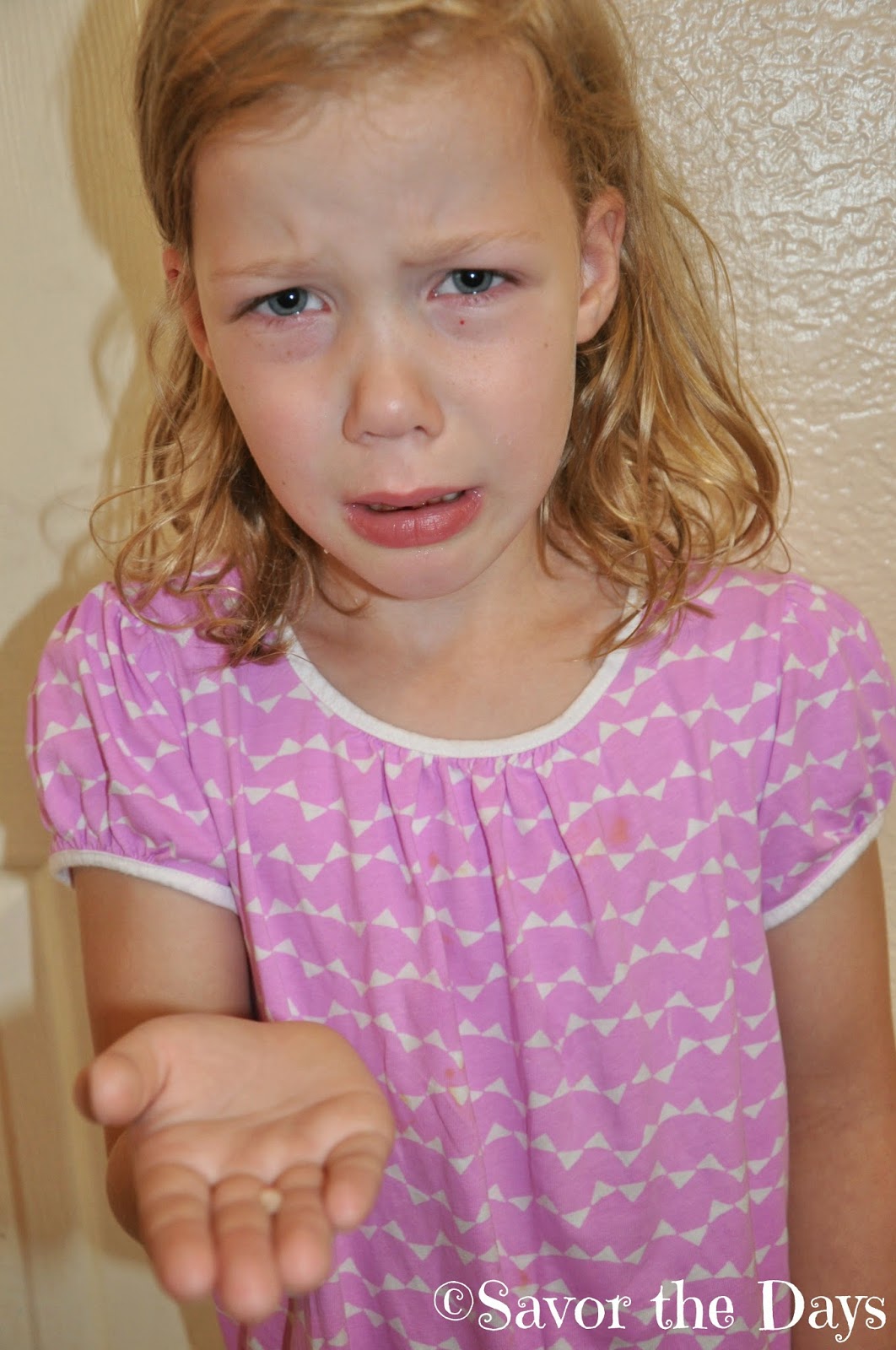 Savor The Days: Rachel Lost Her First Tooth!