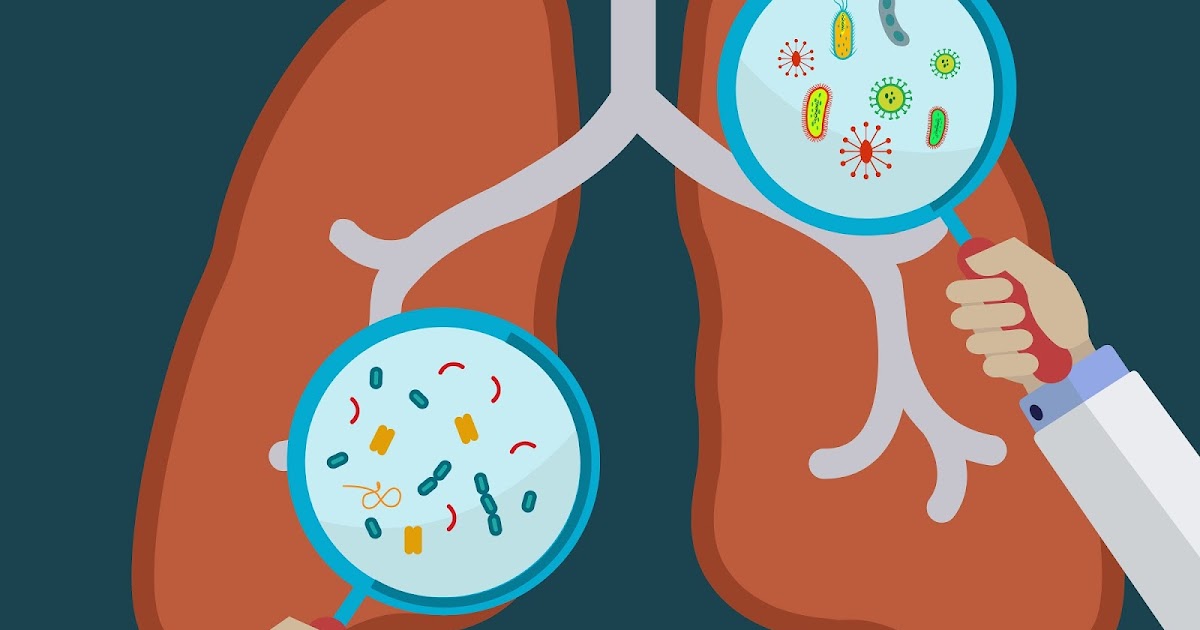 Airway Microbiome in Cystic Fibrosis