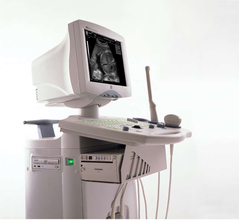 DUNIA MEDIK: MINDRAY ULTRASOUND SCANNER