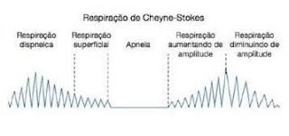 MEDÚVIDAS: COMO OCORRE A RESPIRAÇÃO DE CHEYNE-STOKES