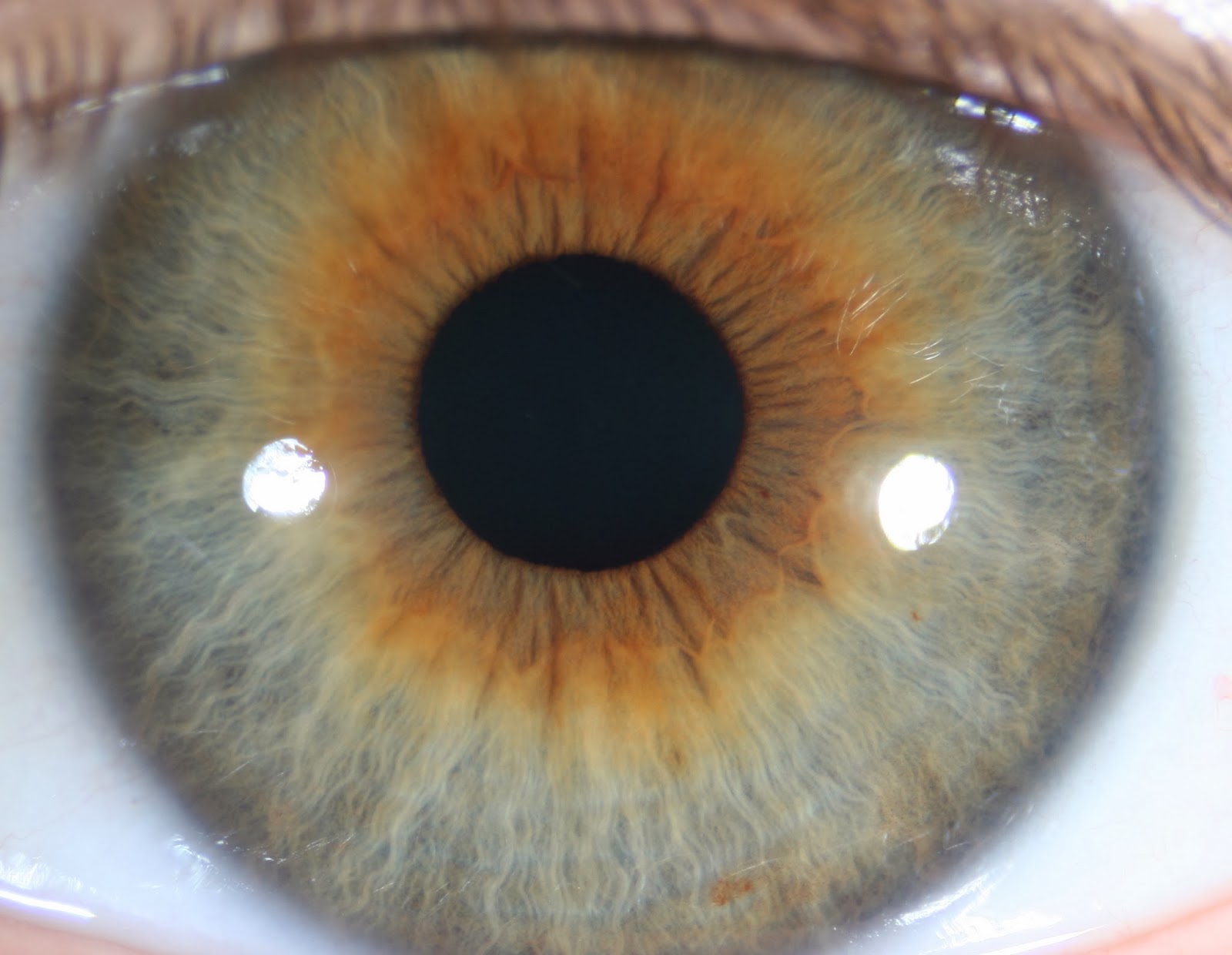 Modern & Multidimensional Iridology: Orange Central Heterochromia ...