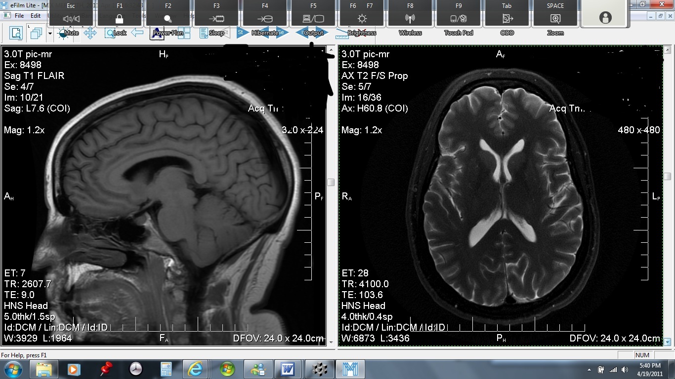 Pobble Thoughts: The Good, The Bad, and The Ugly