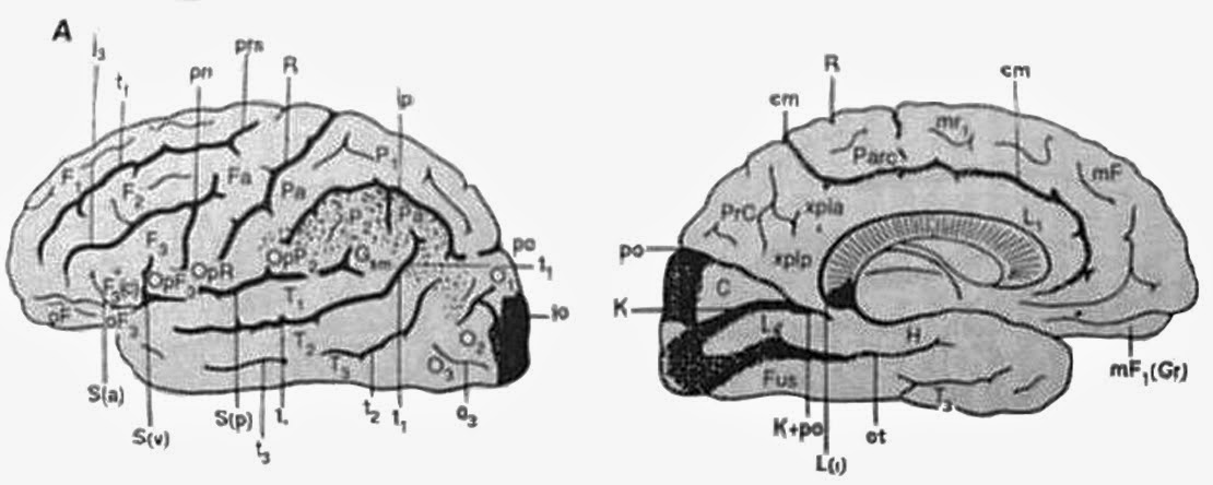 Mundo Afasia: Alexia