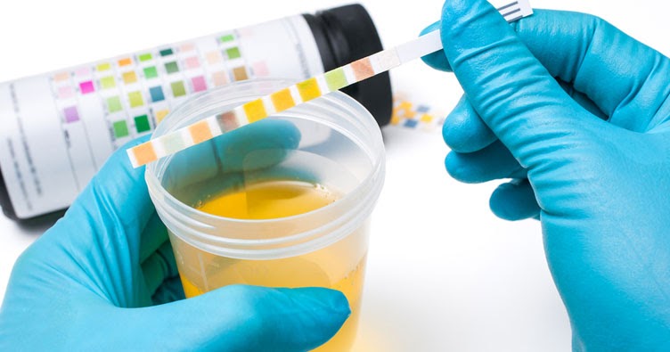 Karoline Cruciani: VEM VER O QUE A COR DA SUA URINA INDICA SOBRE SUA SAUDE