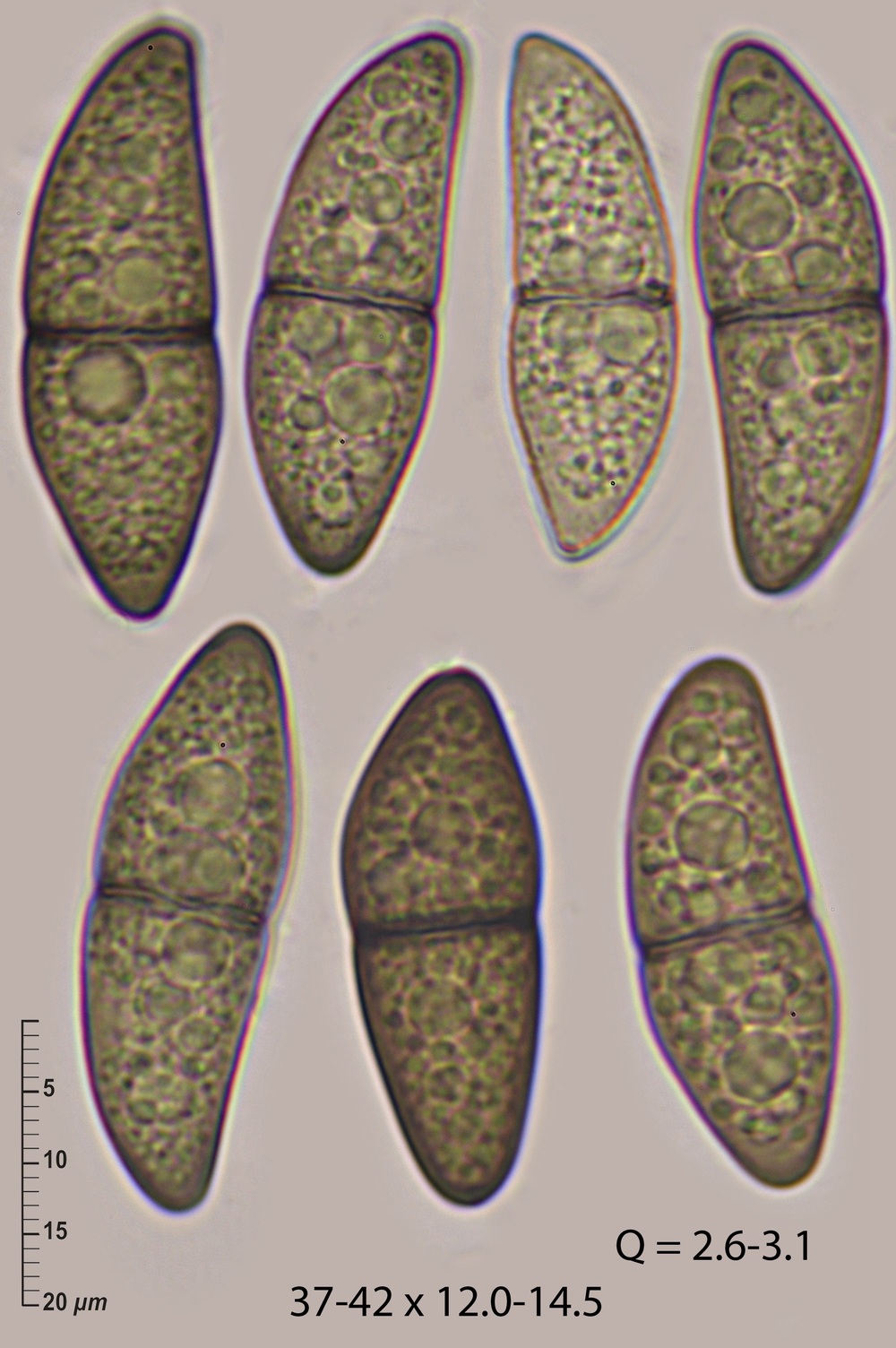 Jahnula aquatica (Plöttn. & Kirschst.) Kirschst. • CEMAS Orden Jahnulales