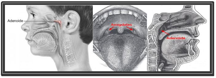 Adenoide o que é?