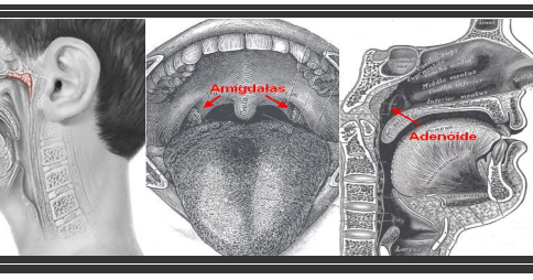 Adenoide o que é?