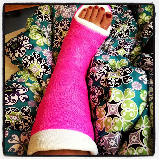 Casts and Toes: Random Assortment of Cast Pics