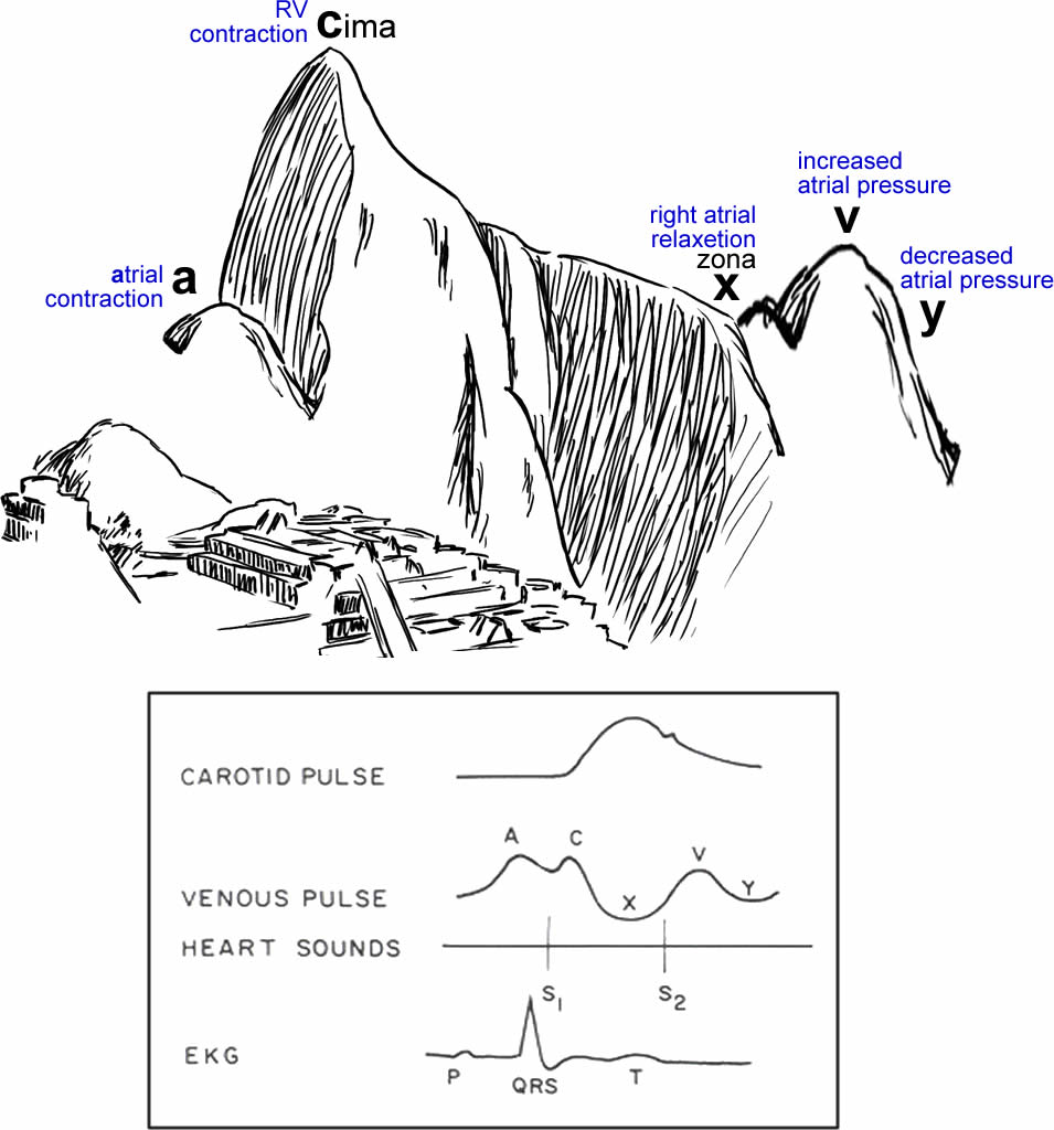 Medical MindMaps for USMLE Step 1: Jugular Venous Pulse