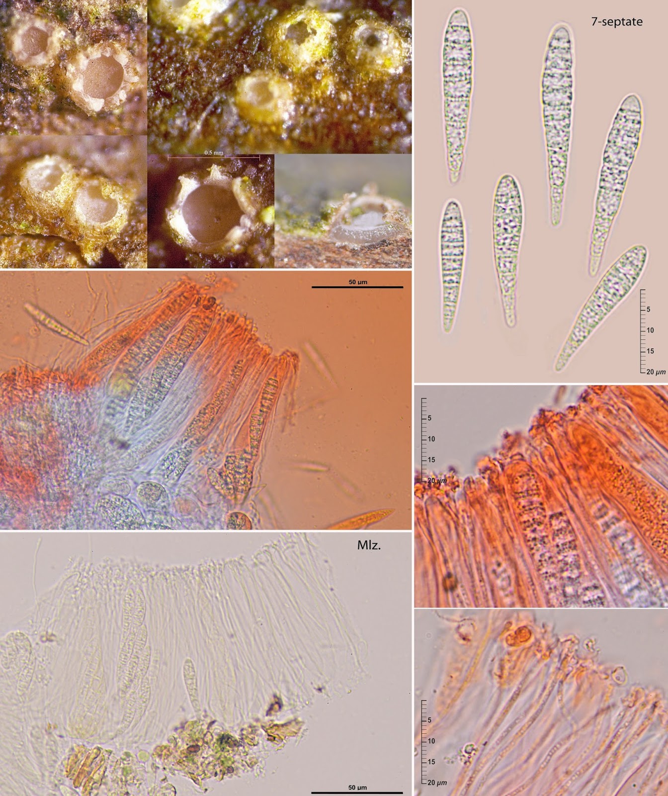 Karstenia rhopaloides (Sacc.) Baral • CEMAS
