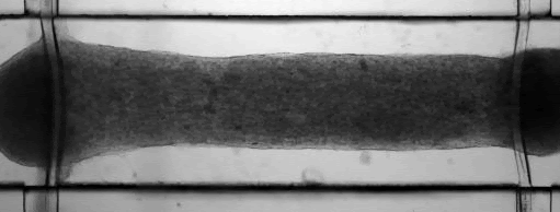 PRODUCCIÓN DE TEJIDO DE CORAZÓN HUMANO CON PLATAFORMA BIOWIRE II ...