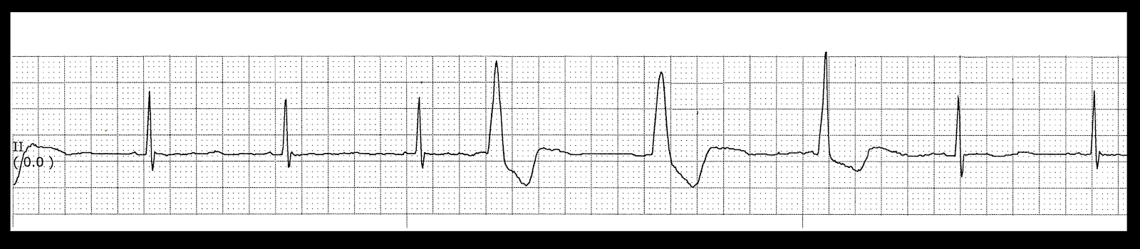 Various Escape Beats