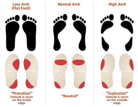 Dokter Sports: Cara Mengetahui Tipe Kaki
