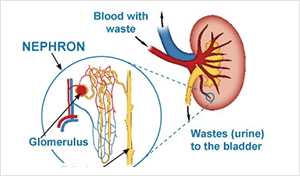 Health Knowledge : Symptoms of Nephrotic Syndrome