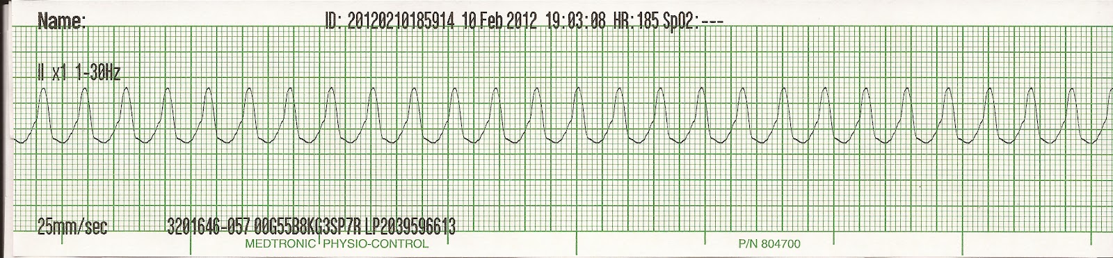 Pediatric Advance Life Support: SVT Part 1