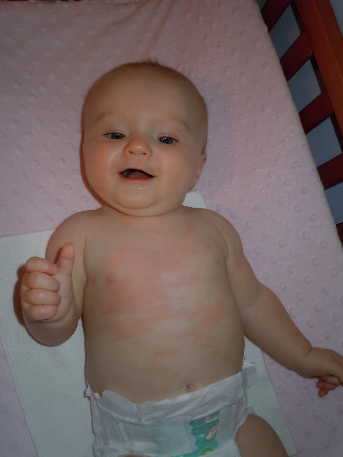 Lanwer Family Blog: Sweet potato allergy? Really?