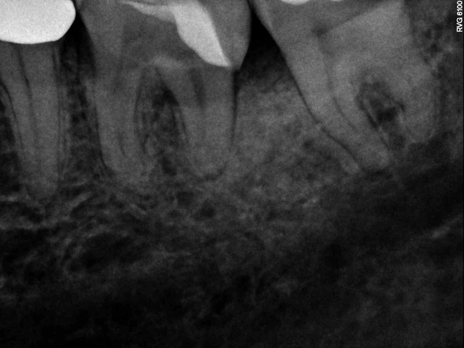 WM 51 - Bauer Smiles