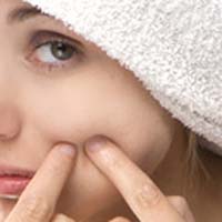 DUNIA CEWEK: Jerawat Batu di Muka