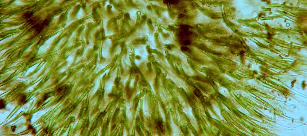 Rafael Microfauna Marina: Calothrix crustacea (Cianobacterias)