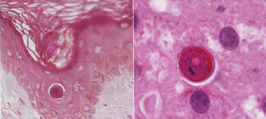 calatayud1497222 : ADAPTACIONES CELULARES, LESIÓN CELULAR Y MUERTE CELULAR