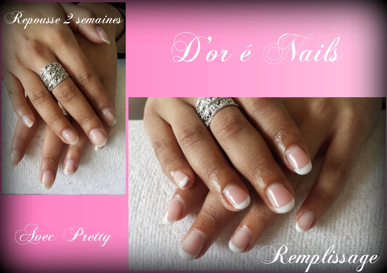 Cattleya Nails et Ces Informations: Les différentes formes d'ongles.
