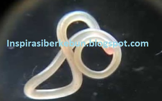 Yuk Basmi Parasit Berbahaya di Dalam Tubuh dengan 5 Cara ini ...