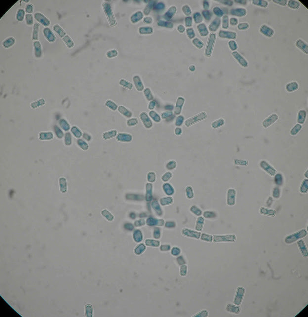 ATLAS MICOLOGIA: MAGNUSIOMYCES CAPITATUS