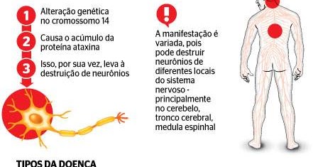 Blog da Biblioteca do IC/FUC: Doença de Machado-Joseph