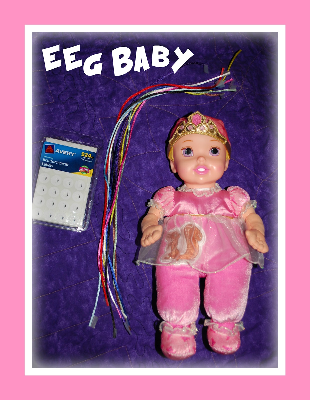 Miniature Stump: EEG 08/02/12