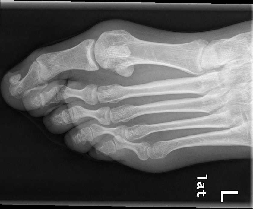 Fanáticos del pie: abril 2012