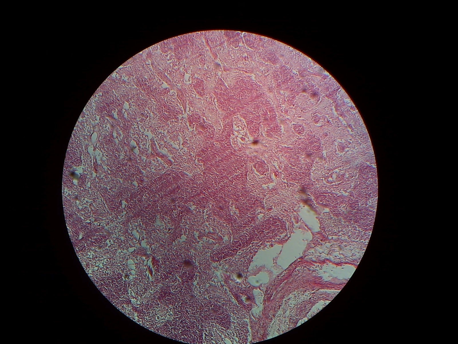 Ca - CaDo (Catatan Calon Dokter): Blok 11 : Praktikum Patologi Anatomi ...