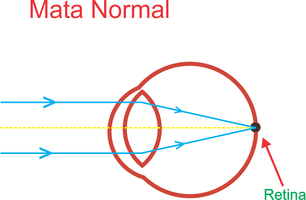 Cahaya dan Alat Optik : Titik Dekat dan Titik Jauh Mata ~ CAKRAWALA ...