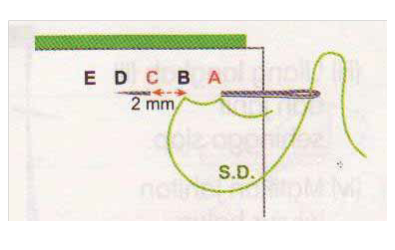 Skor A+ RBT: JENIS JAHITAN