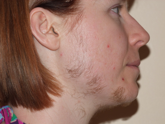 Health Symptoms : Causes, Treatment, Conditions and More