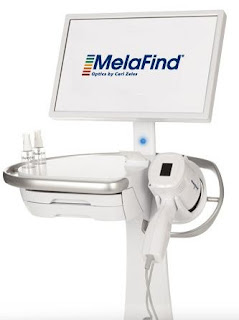 What Does Your Mole Look Like? MelaFind Can Help You! | SpoiledLatina