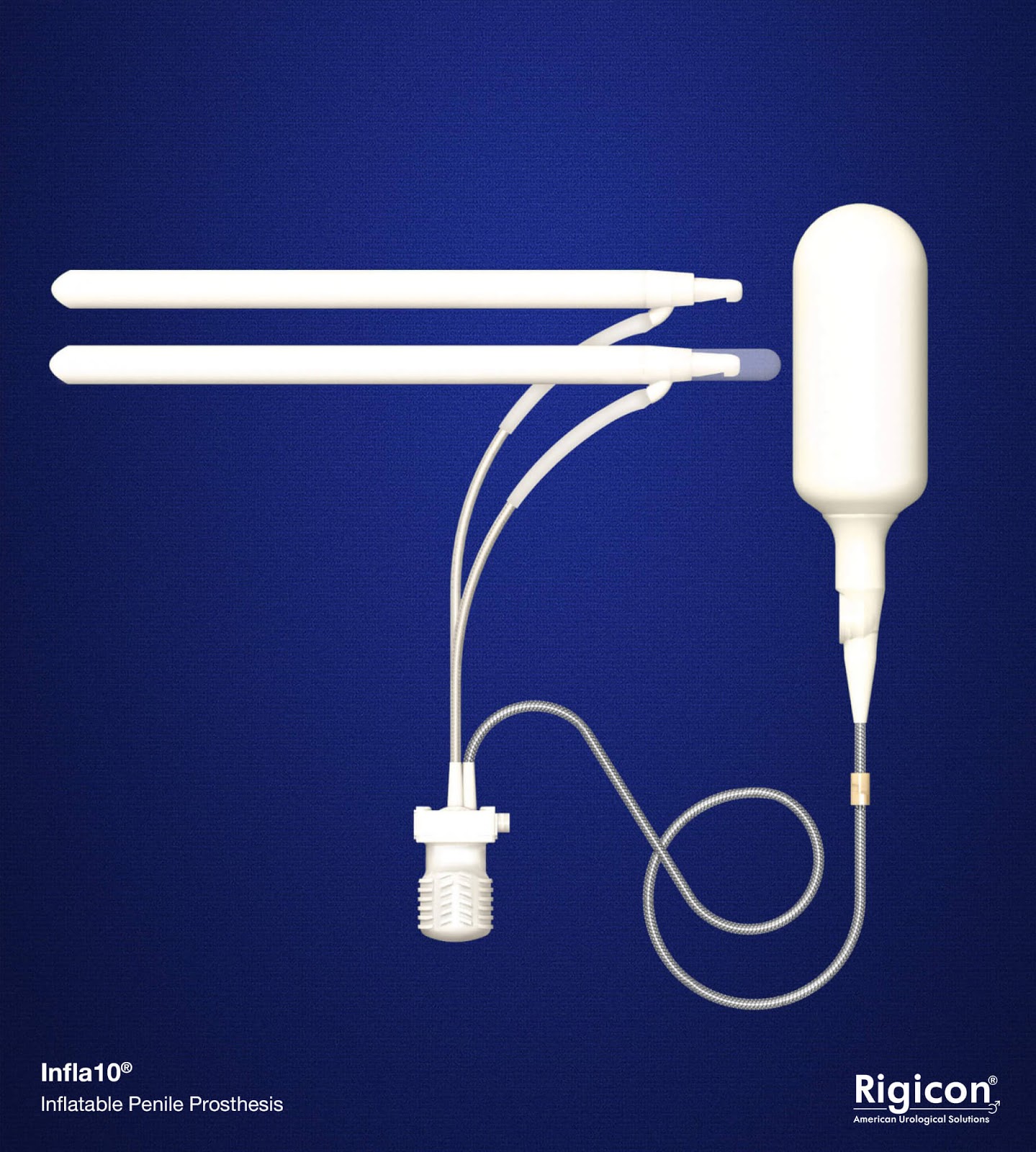 Inflatable Penile Prosthesis — Three-Piece - Rigicon® Infla10®
